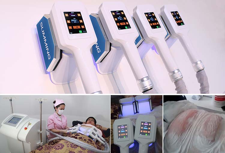 Cool Vacuum Cryolipolysis Slimming Fat Freezing Machine - Beijing VCA ...