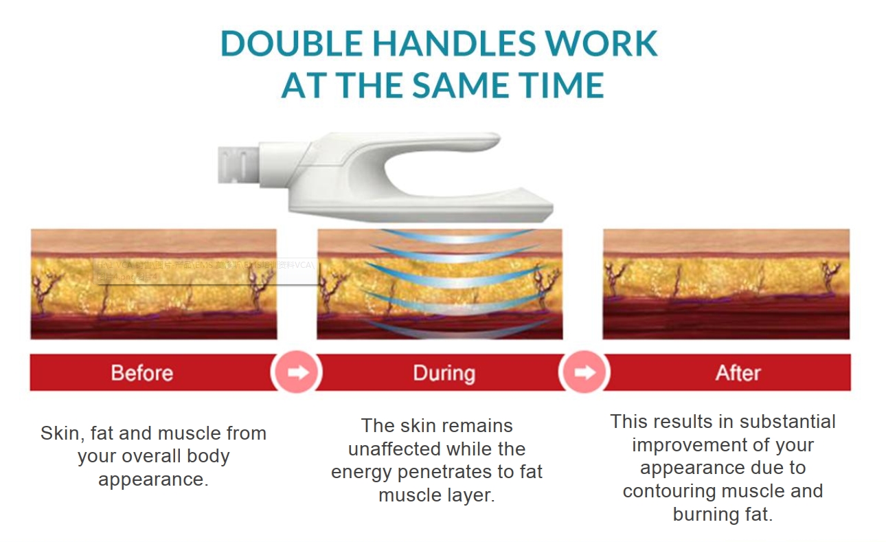 2021 New designed model for EM-Sculpt build muscle machine - Beijing ...